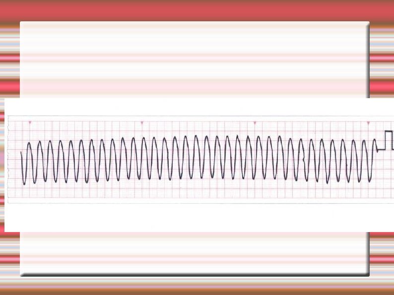 Basic principles of advanced hemodynamic monitoring in anesthesia