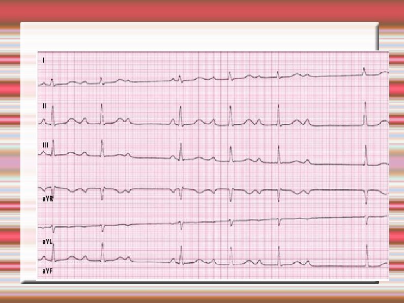 Basic principles of advanced hemodynamic monitoring in anesthesia