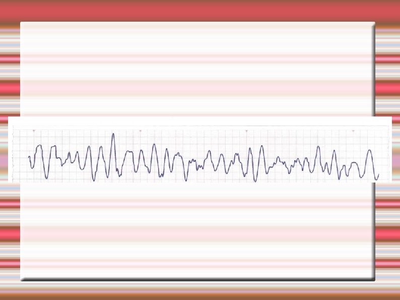 Basic principles of advanced hemodynamic monitoring in anesthesia