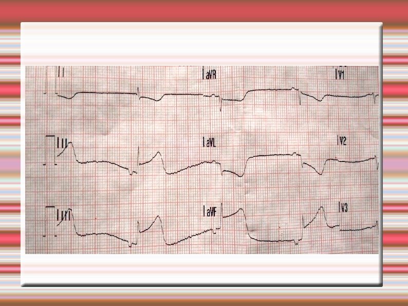 Basic principles of advanced hemodynamic monitoring in anesthesia