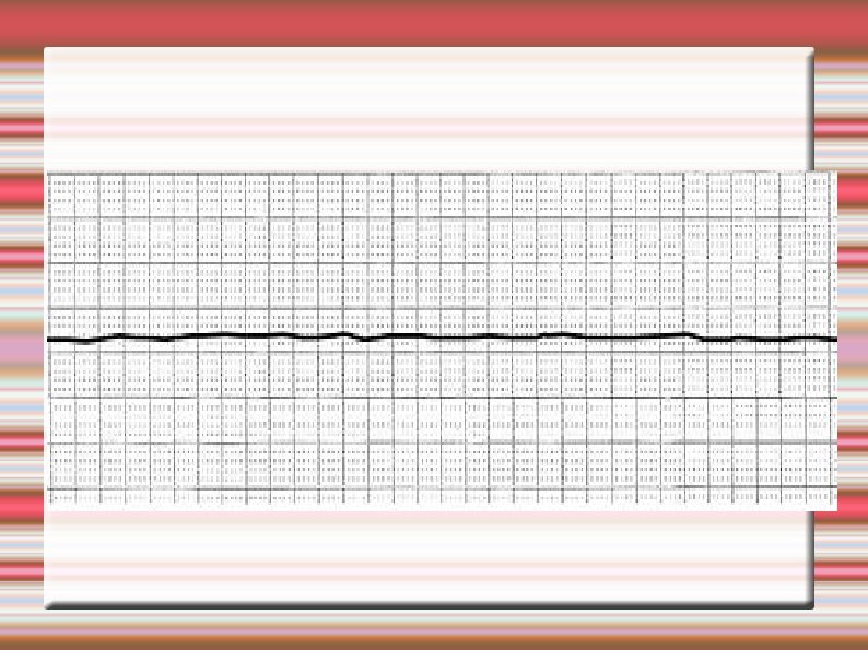 Basic principles of advanced hemodynamic monitoring in anesthesia