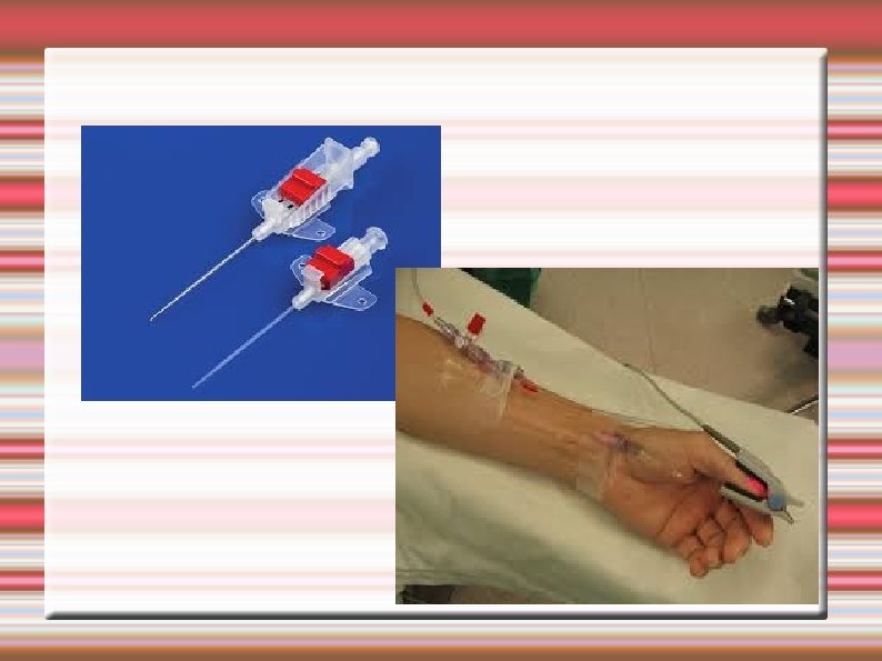 Basic principles of advanced hemodynamic monitoring in anesthesia