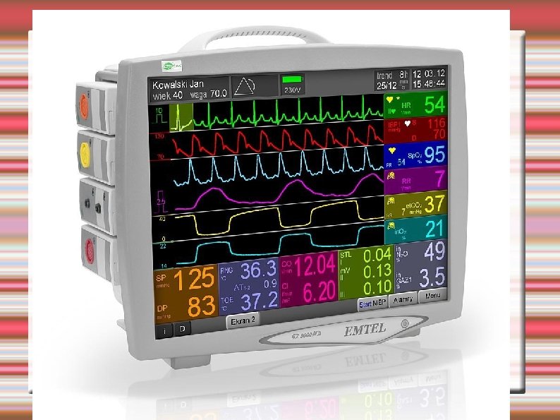 Basic principles of advanced hemodynamic monitoring in anesthesia