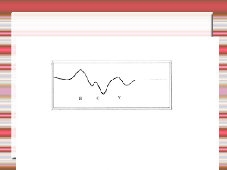 Basic principles of advanced hemodynamic monitoring in anesthesia