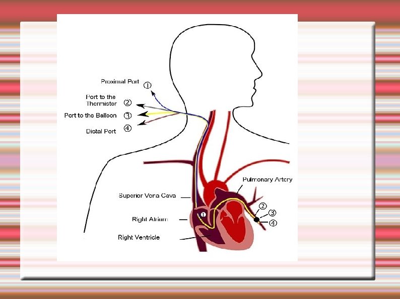 Basic principles of advanced hemodynamic monitoring in anesthesia