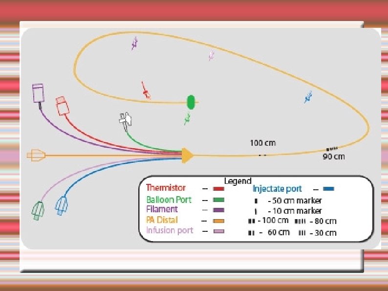 Basic principles of advanced hemodynamic monitoring in anesthesia