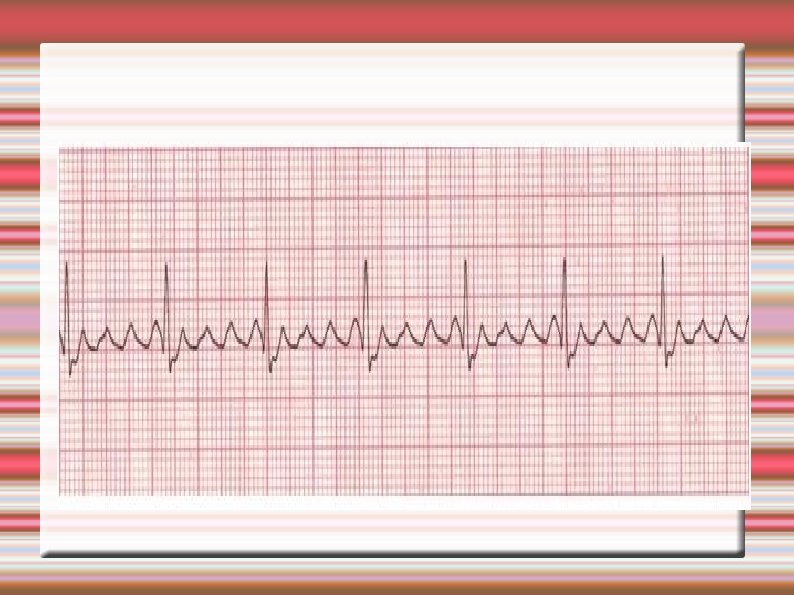Basic principles of advanced hemodynamic monitoring in anesthesia
