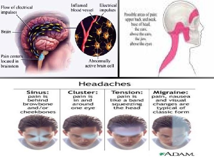 Headaches By Gabie Gomez Why does my head