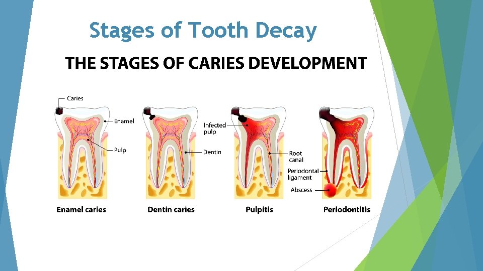 Basics of Oral Health Presentation Contra Costa Health