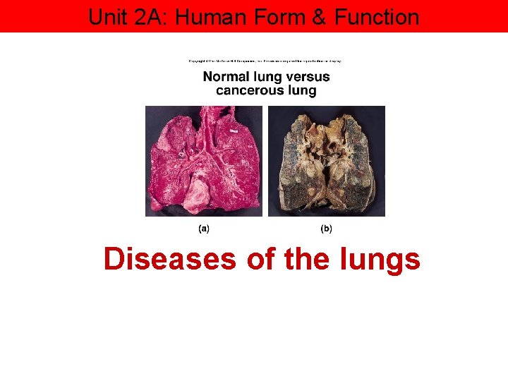 Unit 2 A Human Form Function Diseases of