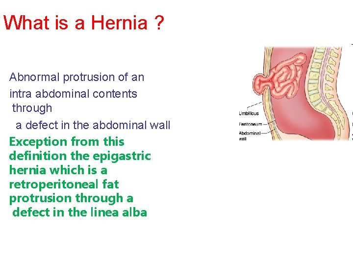 Abdominal wall hernia Hernia strap 1758 What is