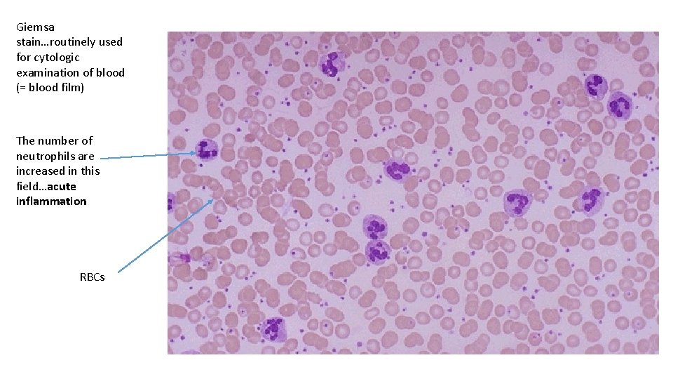 Giemsa stainroutinely used for cytologic examination of blood