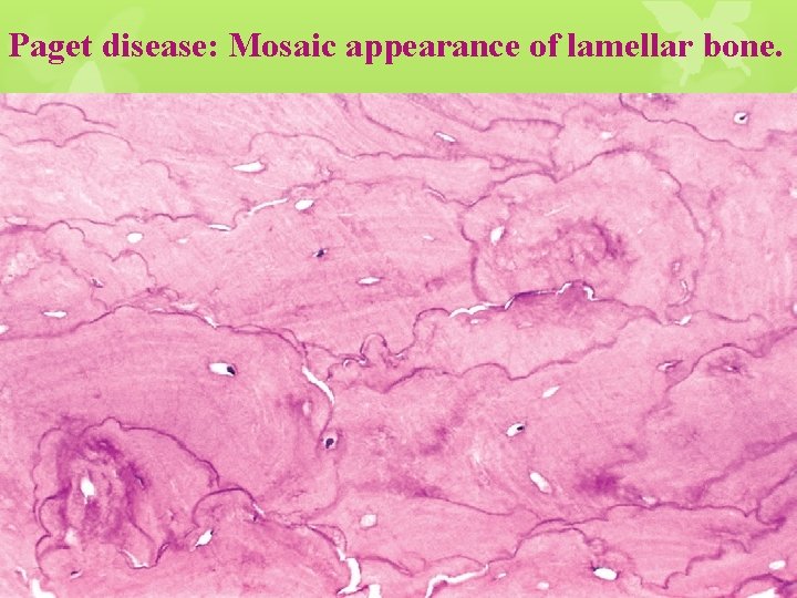Lecture 1 Dr Nadia Sabry AlAni Diseases of