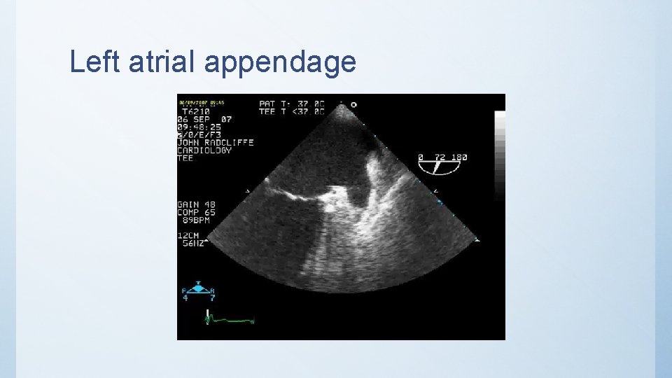 Lecture 18 Foreign bodies Masses Etc Holdorf Foreign
