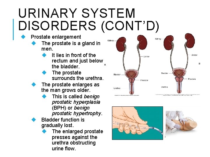 CHAPTER 44 Urinary and Reproducti ve Disorders URINARY