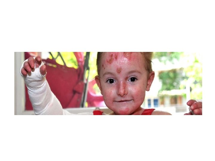 Voluntary Sector DEBRA DEBRA For people whose skin