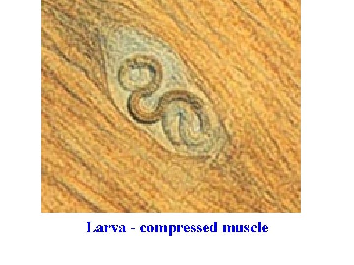 TRICHINOSIS TRICHINIASIS TRICHINELLOSIS Trichinella spiralis ...