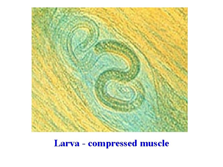 TRICHINOSIS TRICHINIASIS TRICHINELLOSIS Trichinella spiralis ...