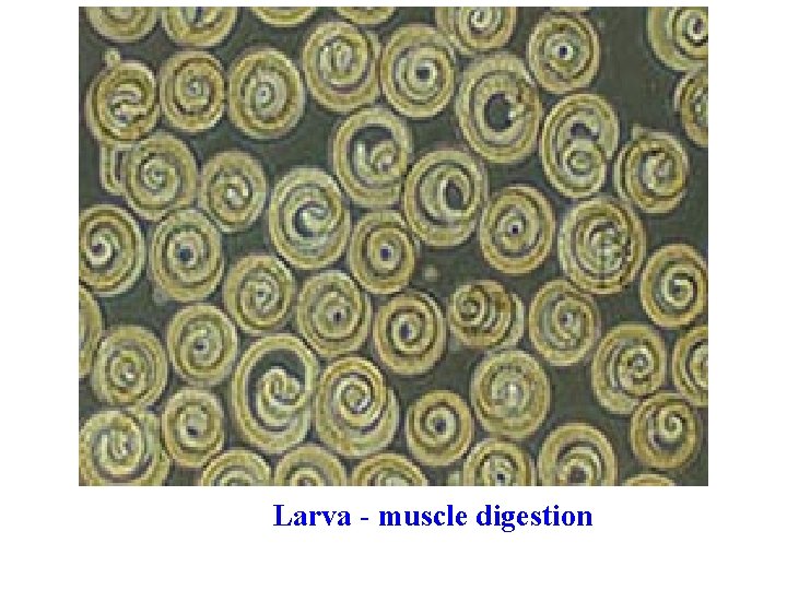 TRICHINOSIS TRICHINIASIS TRICHINELLOSIS Trichinella spiralis ...