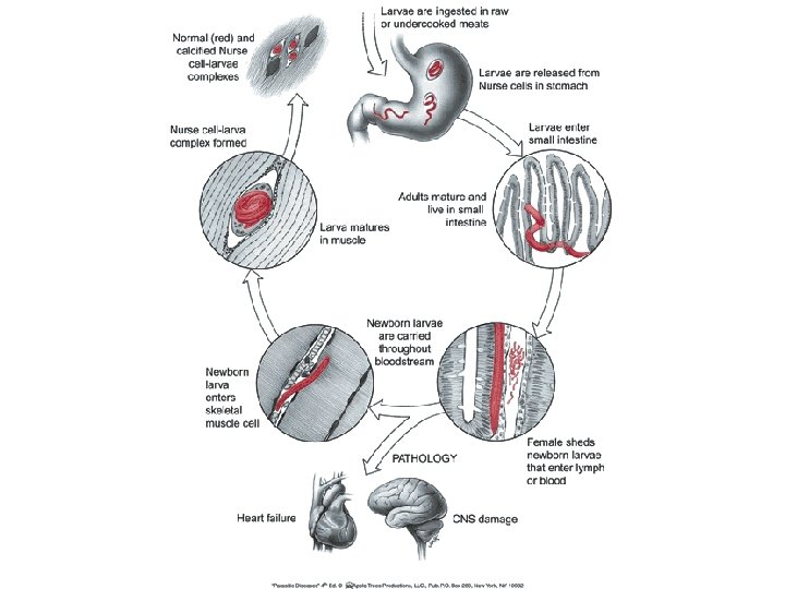 TRICHINOSIS TRICHINIASIS TRICHINELLOSIS Trichinella spiralis ...
