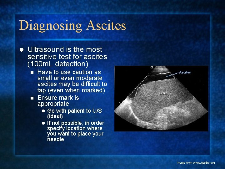 Ascites Management in Patients with Cirrhosis Roadmap l