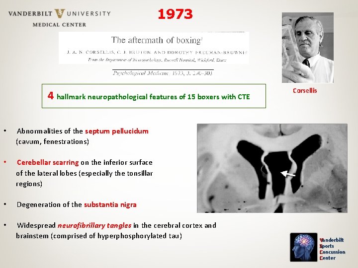 Chronic Traumatic Encephalopathy in Sports Concussion Clinical Update