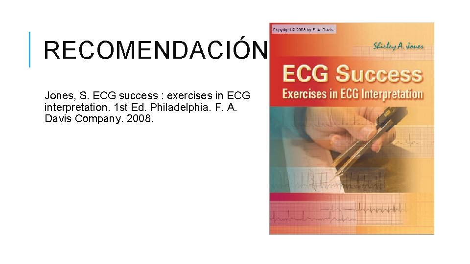 ELECTROCARDIOGRA MA Dra Ma Fernanda Beeche A Laboratorio