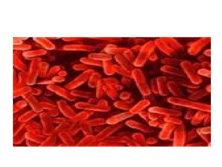 BACTERIA NOTES Bacteria Which one Coccus spirilla bacillus