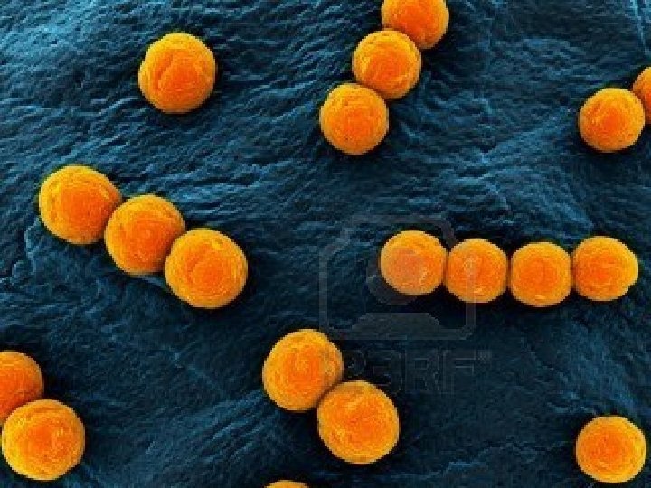 BACTERIA NOTES Bacteria Which one Coccus spirilla bacillus