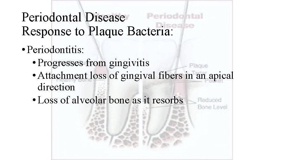 AAP Position Paper Evaluation The Pathogenesis of Periodontal