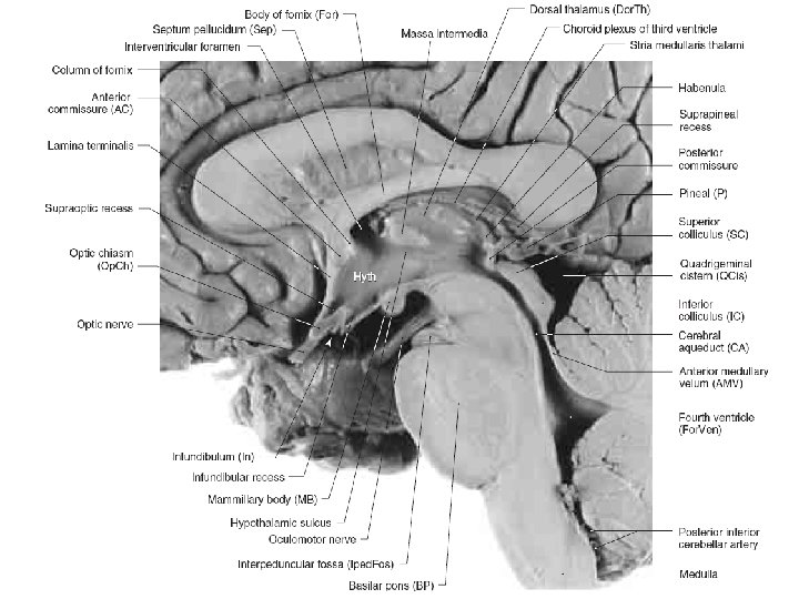 Anatomy of Hypothalamus Kamal Salih Galen of Pergamon