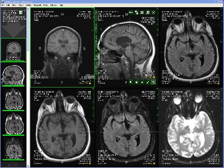 Archiving Experiments Based on Radiological Images Fred Prior