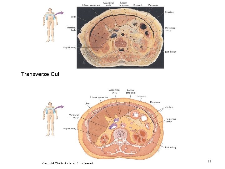 Organization of the Body Chapter 1 Anatomy Physiology