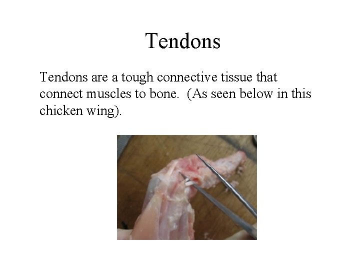The Skeletal System Functions Anatomy of a Bone