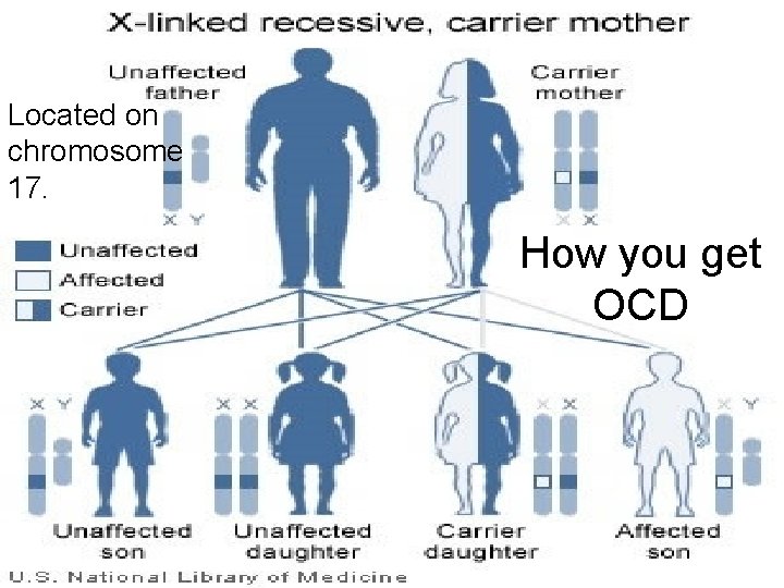 O C D Obsessive Compulsive Disorder Type Cleaning