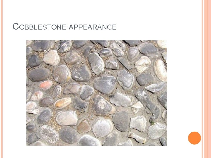 DISEASES OF THE INTESTINES Intestinal obstruction Vascular disorders