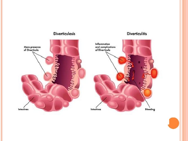 DISEASES OF THE INTESTINES Intestinal obstruction Vascular disorders