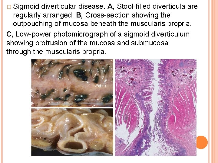DISEASES OF THE INTESTINES Intestinal obstruction Vascular disorders