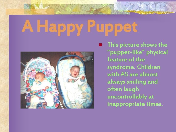 Angelman Syndrome By Jeaneane P Kozlowski Presented July