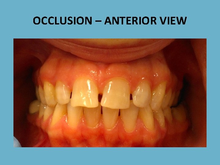 PERIODONTAL CASE STUDY Presented by Samira Kiwan MED