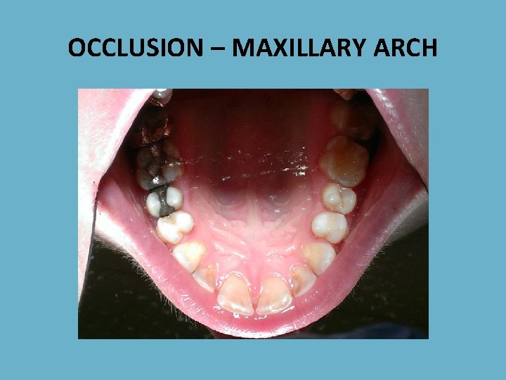 PERIODONTAL CASE STUDY Presented by Samira Kiwan MED