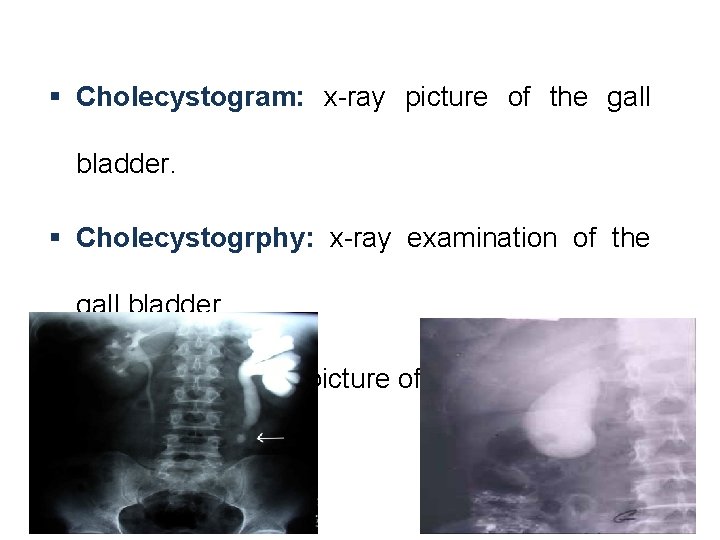 RADIOGRAPHY T SANAA Medical Terms Related To Radiography