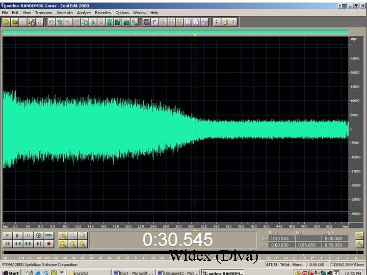 Digital Noise Reduction Understanding Lab and Real World