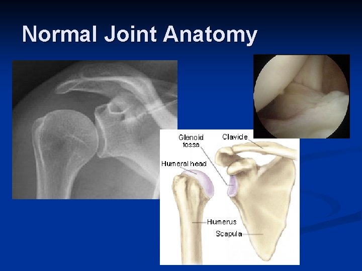 Reverse Shoulder Replacement Normal Joint Anatomy Anatomy Rotator