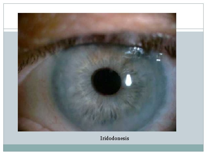 Eye Trauma Evaluation of ocular trauma History Age