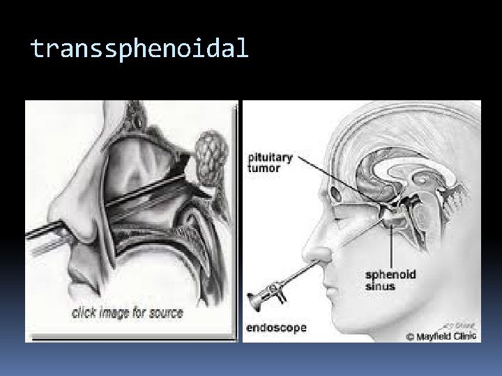 Pituitary gland Gross anatomy of the pituitary gland