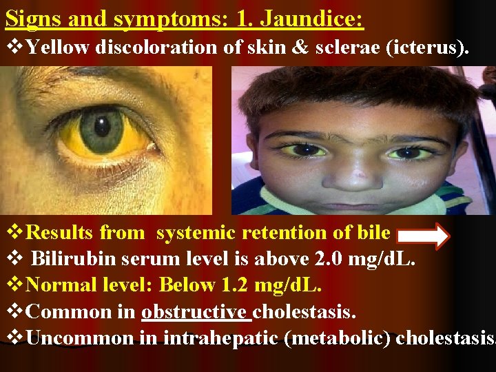 Lecture 8 Liver diseases Cholestasis Cirrhosis Liver Normal