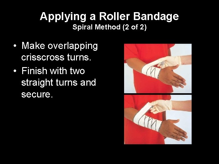 Chapter 10 Bandaging Wounds Dressings 1 of 2