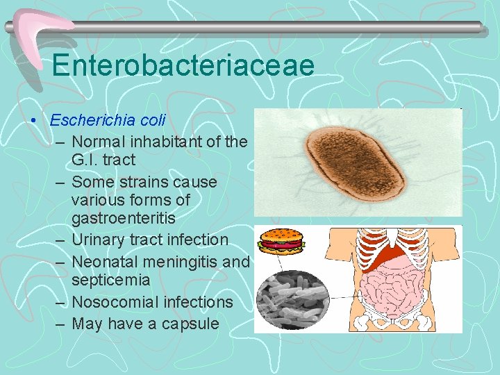 Gastrointestinal tract infection Dr Amin Aqel Ph D