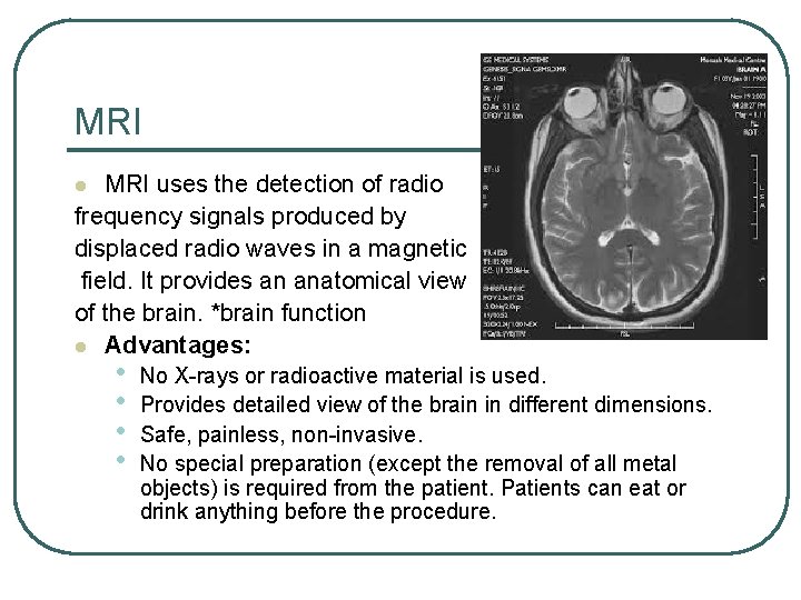 Brain Imaging 02192015 PET Scans images reflect blood